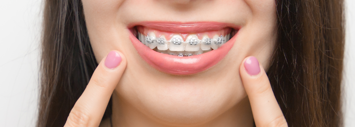 Termina el 2024 eligiendo los mejores tipos de brackets